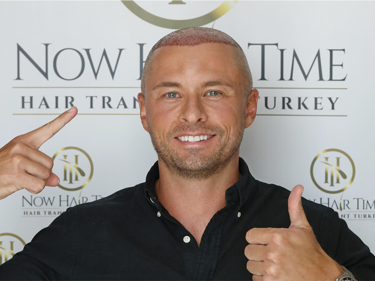 Hair Transplant in Istanbul at Now Hair Time - Now Hair Time